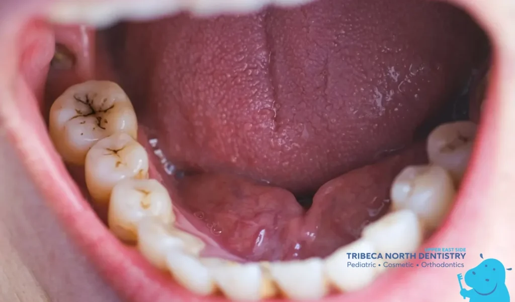 What Causes Tooth Pain? Common Reasons to Know